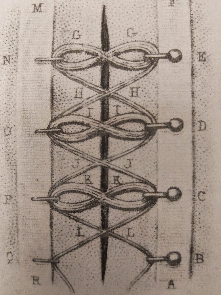 The Roman Army Medical Service - Malton Museum